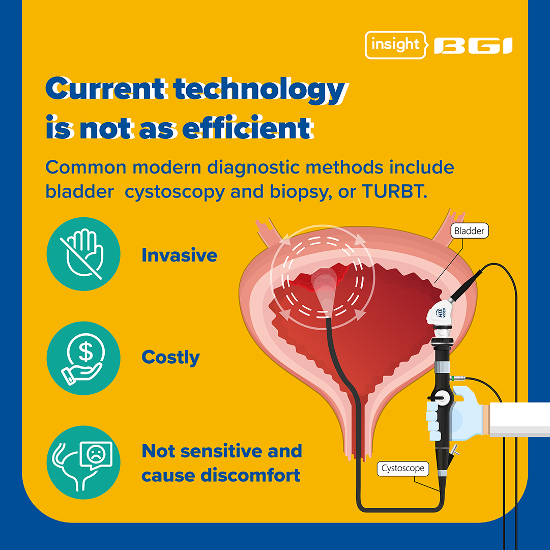 How Do They Check For Bladder Cancer at Eva Gopinko blog