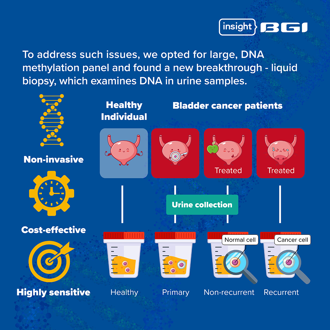 Detecting Bladder Cancer: Best Tests and... - Arkangel AI
